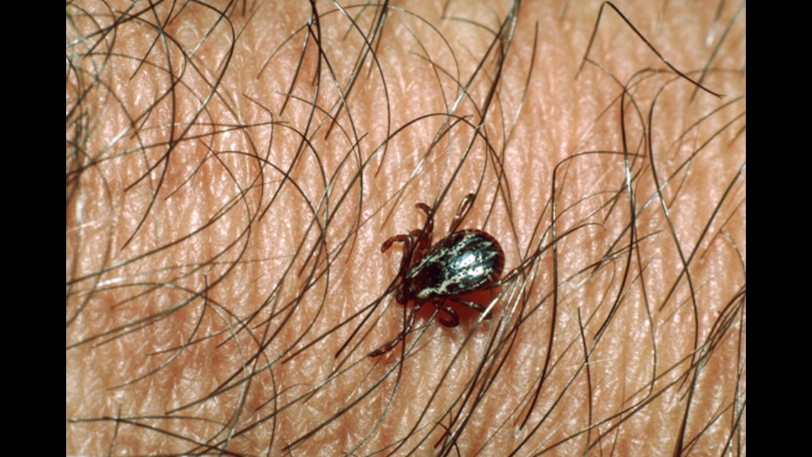 Should I burn a tick off? 5 common myths about ticks | wwltv.com