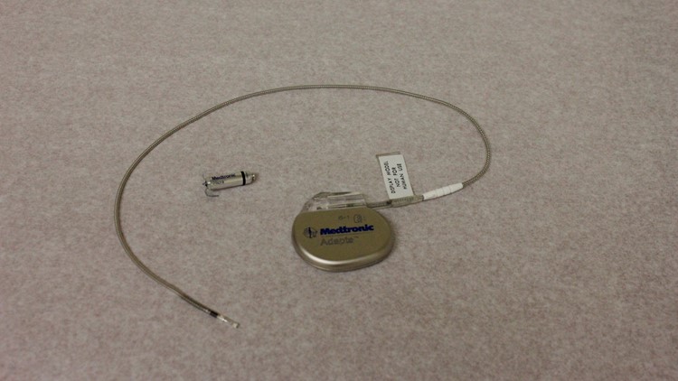 Smallest, wireless pacemaker offered at Tulane Medical Center | wwltv.com