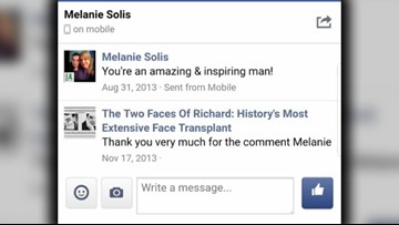 After surviving first-ever face transplant, Covington man needs another ...