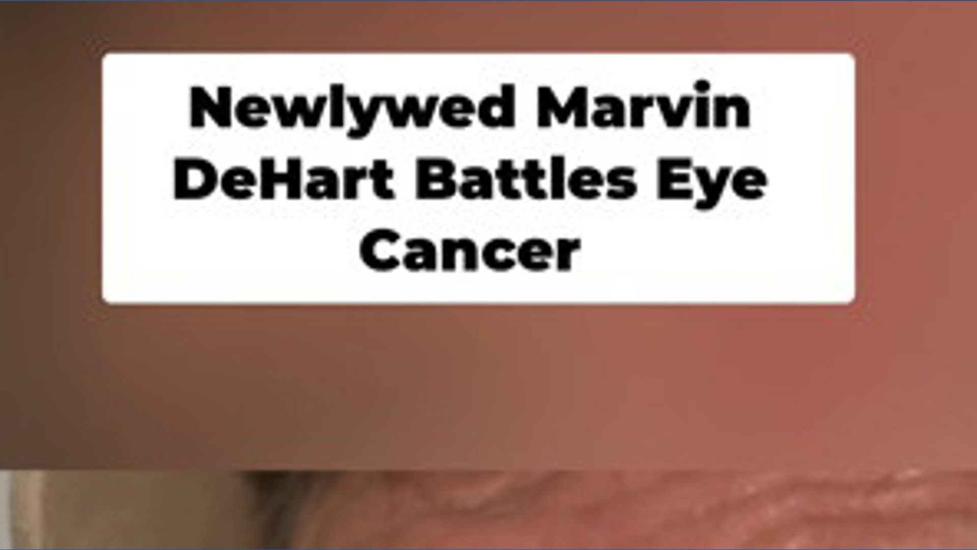 Man battles eye cancer after years of welding | wwltv.com