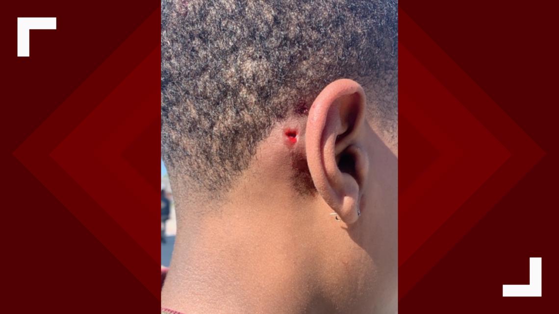 Mother says son was hit with gun outside of school, she was never ...