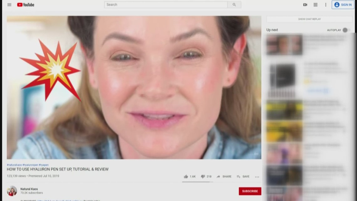 Wrinkle Free Friday: Are at-home fillers safe? | wwltv.com