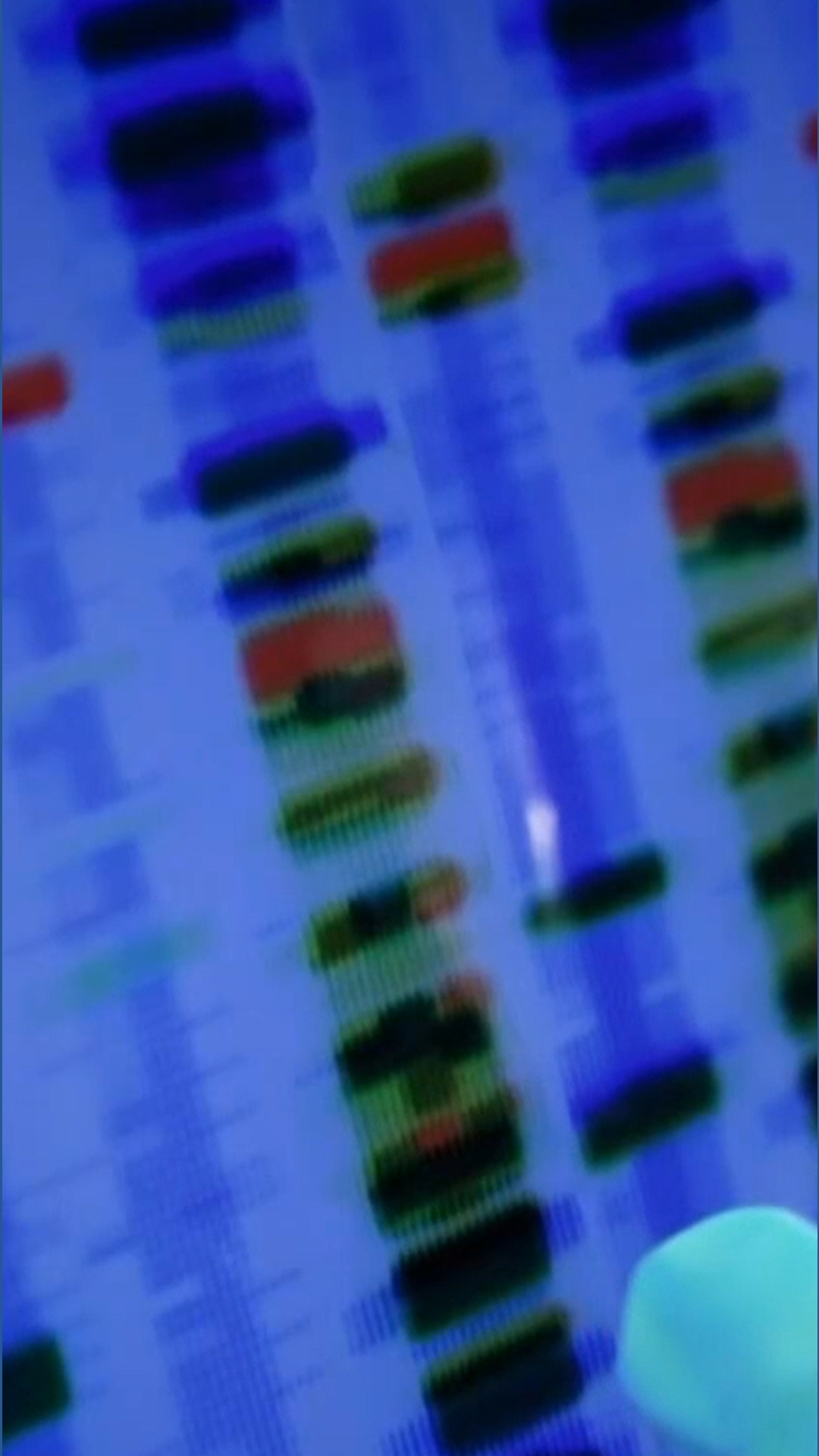 Ochsner researching whether a blood test can find hidden cancers ...
