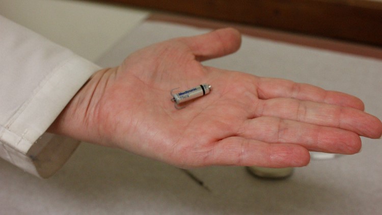 Smallest, wireless pacemaker offered at Tulane Medical Center | wwltv.com